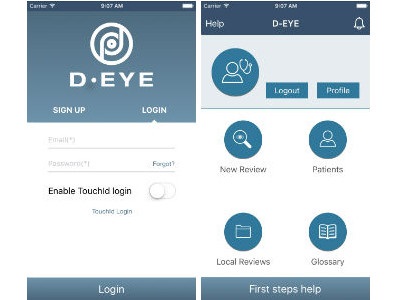D-EYE Launches App Version 2.0 | OptometryWeb: The Ultimate Online ...